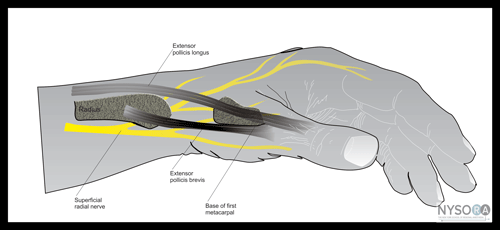 Essentials of Regional Anesthesia Anatomy - NYSORA The New York School ...