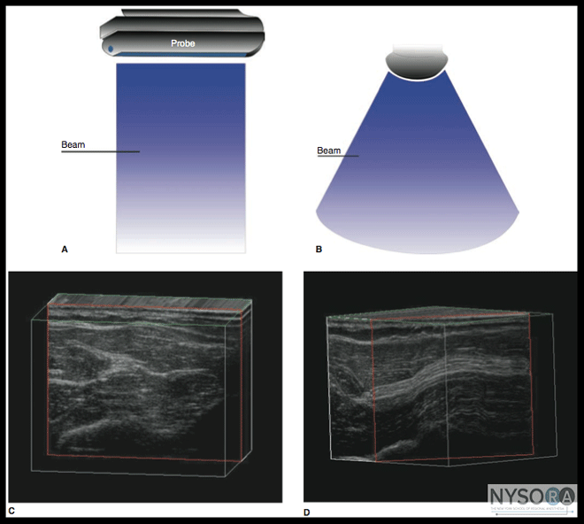 Ultrasound Physics Nysora The New York School Of Regional Anesthesia