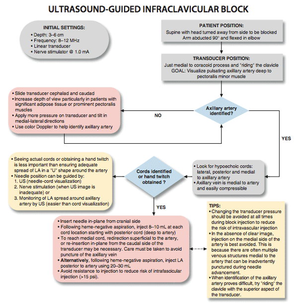 Ultrasound-Guided Infraclavicular Brachial Plexus Block - NYSORA The ...