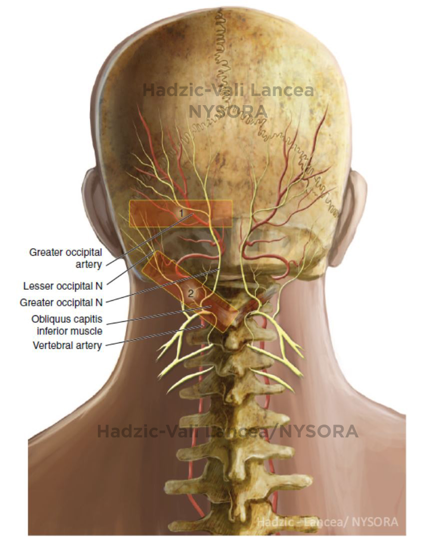 Nerve Blocks of the Face - NYSORA The New York School of Regional ...