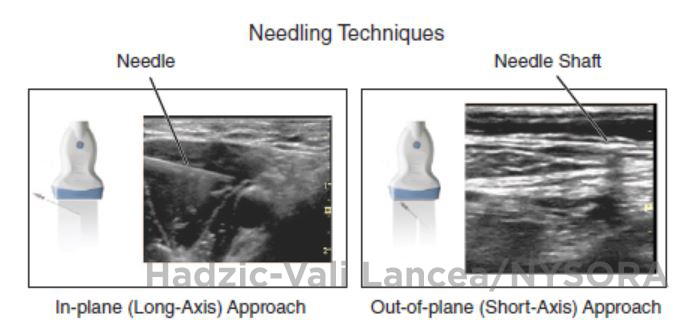 Optimizing an Ultrasound Image - NYSORA The New York School of Regional ...