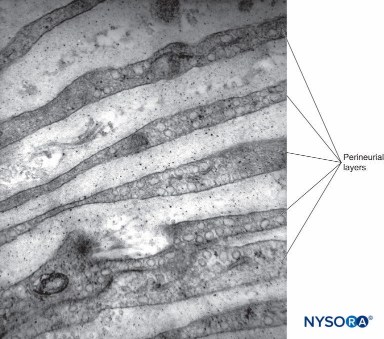 Connective Tissues of Peripheral Nerves - NYSORA