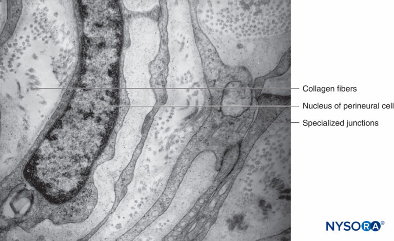 Connective Tissues of Peripheral Nerves - NYSORA