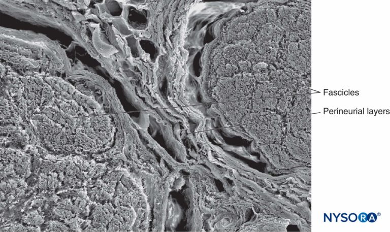 Connective Tissues of Peripheral Nerves - NYSORA