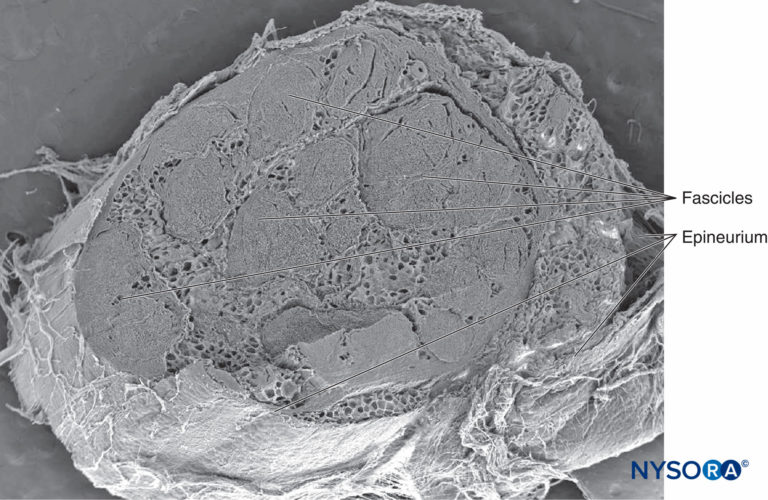 Connective Tissues of Peripheral Nerves - NYSORA