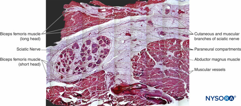 Connective Tissues of Peripheral Nerves - NYSORA