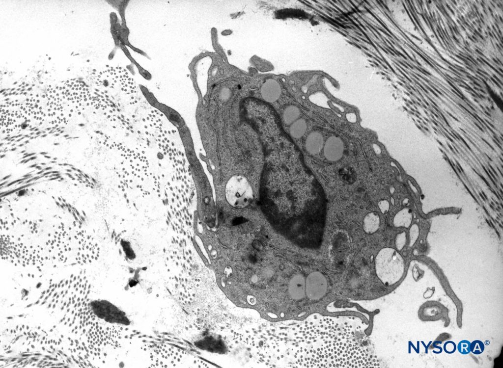 Anatomía ultraestructural de las meninges espinales y estructuras ...