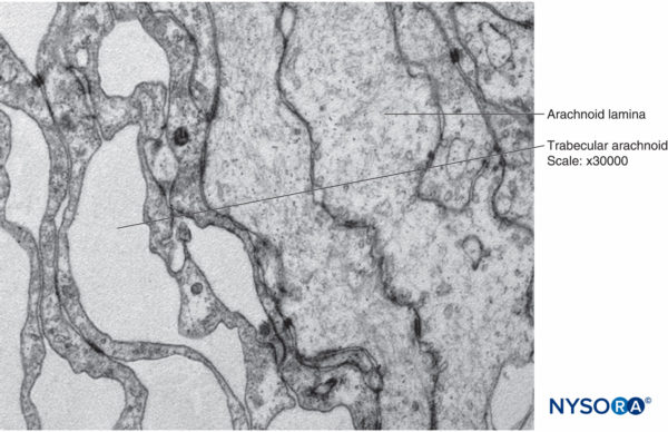 Ultrastructural Anatomy of the Spinal Meninges and Related Structures ...