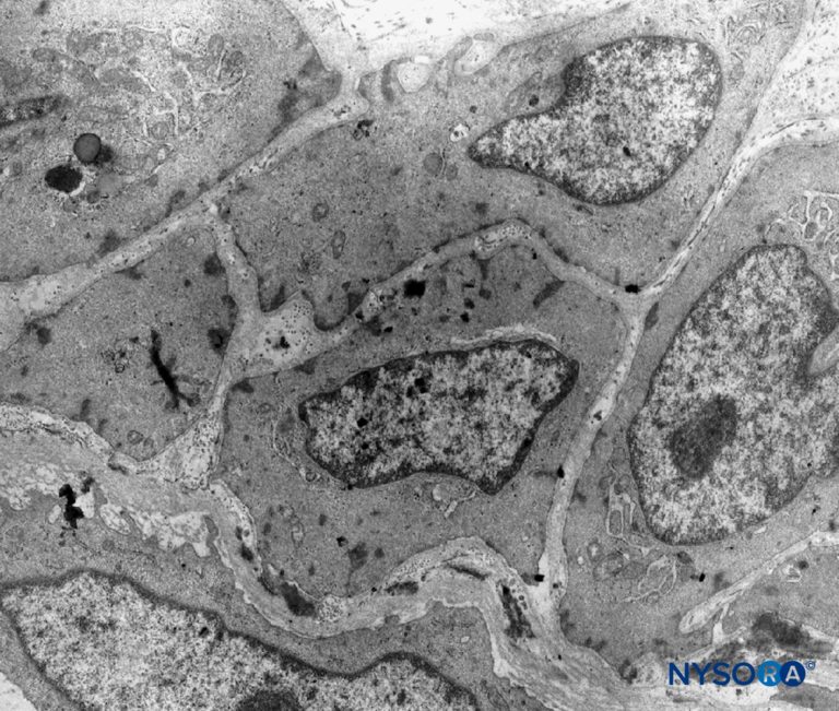 Anatomía ultraestructural de las meninges espinales y estructuras ...