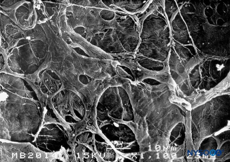 Ultrastructural Anatomy of the Spinal Meninges and Related Structures ...