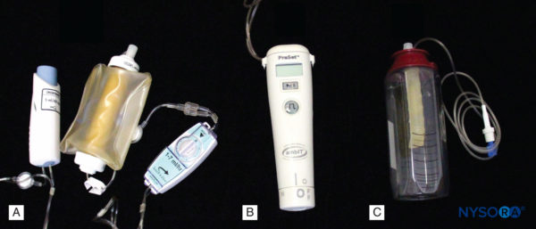 Continuous Peripheral Nerve Blocks: Local Anesthetic Solutions and ...