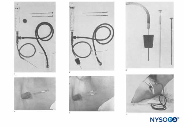 Equipment for Continuous Peripheral Nerve Blocks - NYSORA