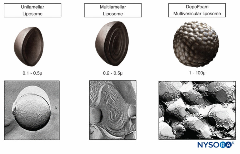 Controlled-Release Local Anesthetics - NYSORA