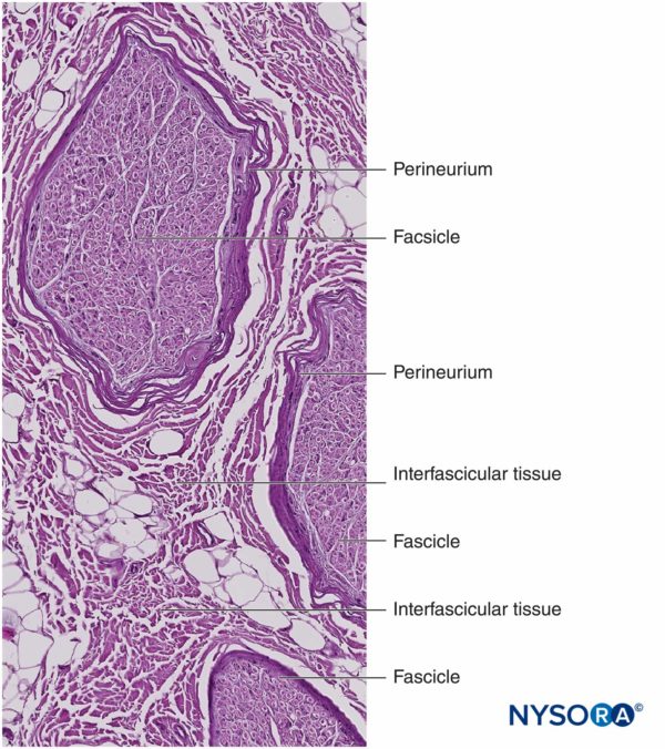 Complications and Prevention of Neurologic Injury with Peripheral Nerve ...