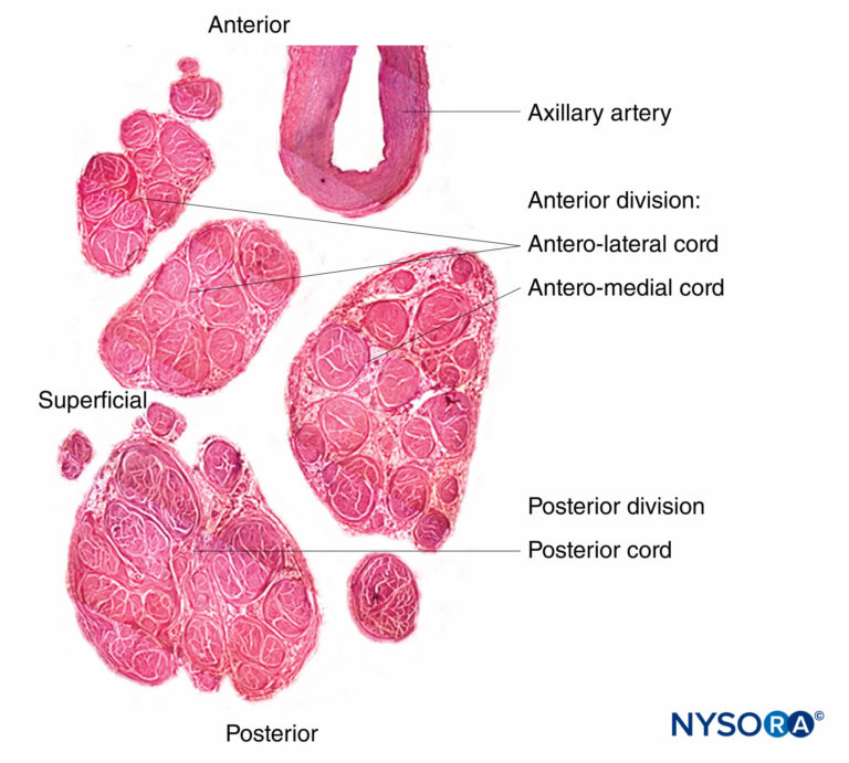 Complications and Prevention of Neurologic Injury with Peripheral Nerve ...