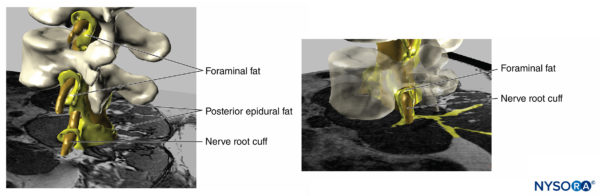 Complications and Prevention of Neurologic Injury with Peripheral Nerve ...