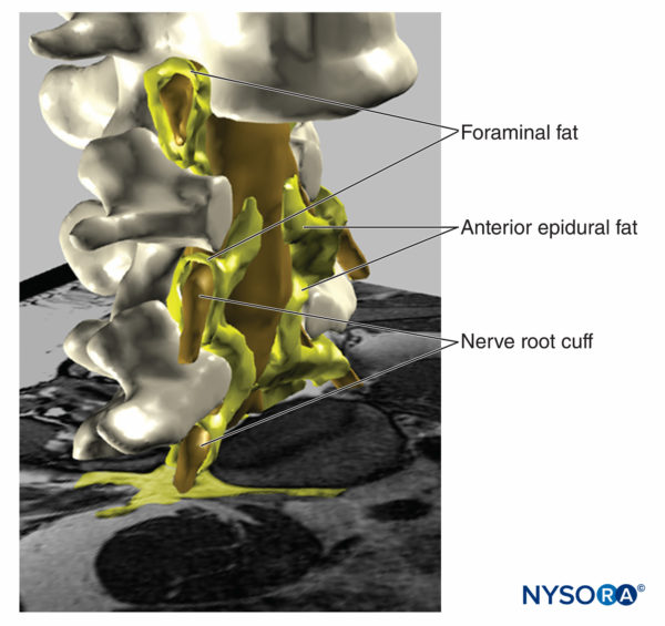 Complications and Prevention of Neurologic Injury with Peripheral Nerve ...