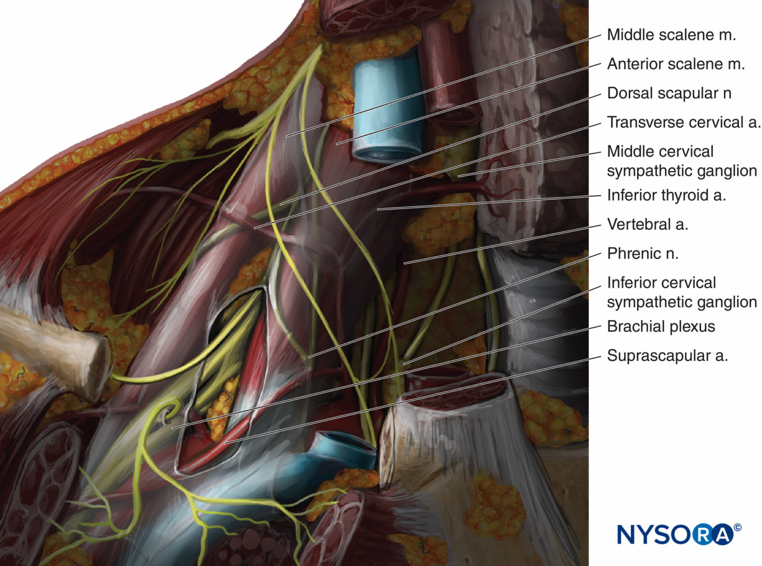 Supraclavicular Brachial Plexus Block - Landmarks and Nerve Stimulator ...