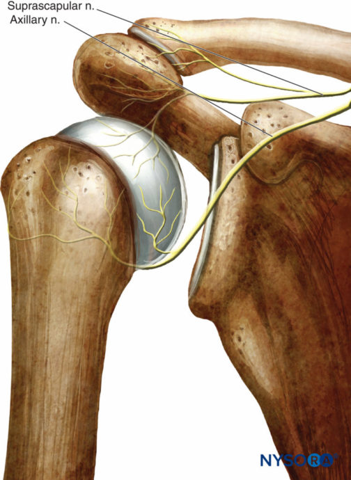 Interscalene Brachial Plexus Block - Landmarks and Nerve Stimulator ...