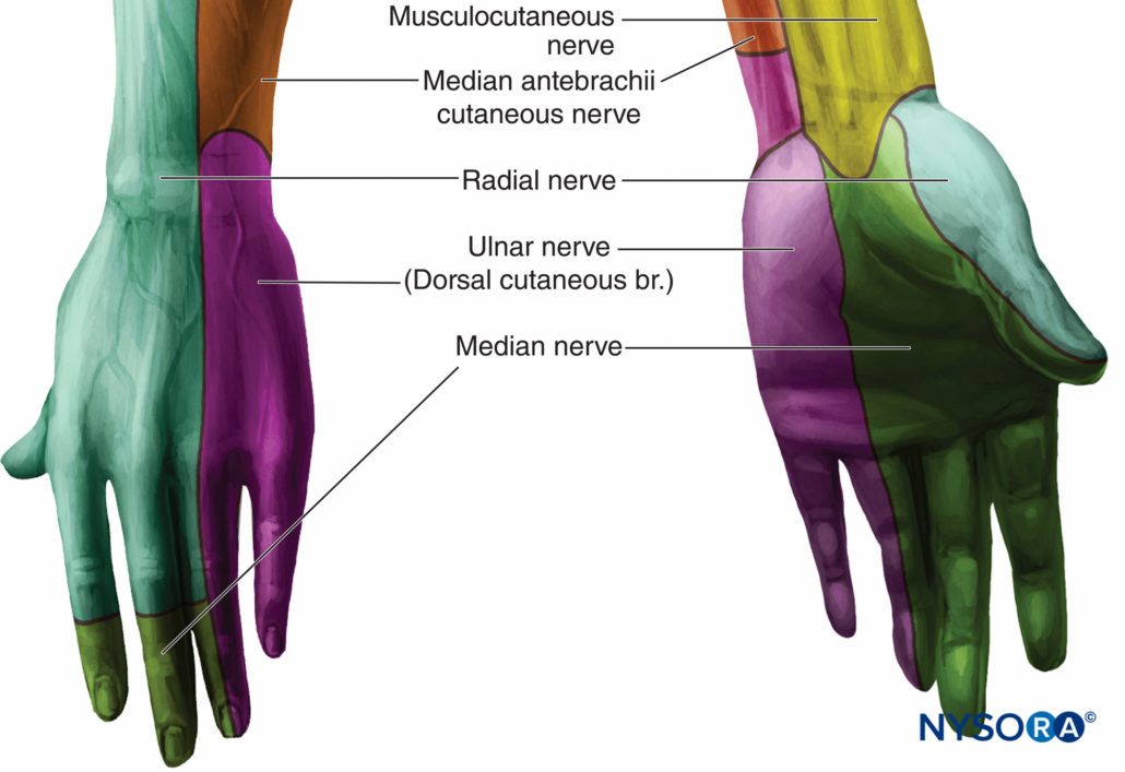 Wrist Block - Landmarks and Nerve Stimulator Technique - NYSORA