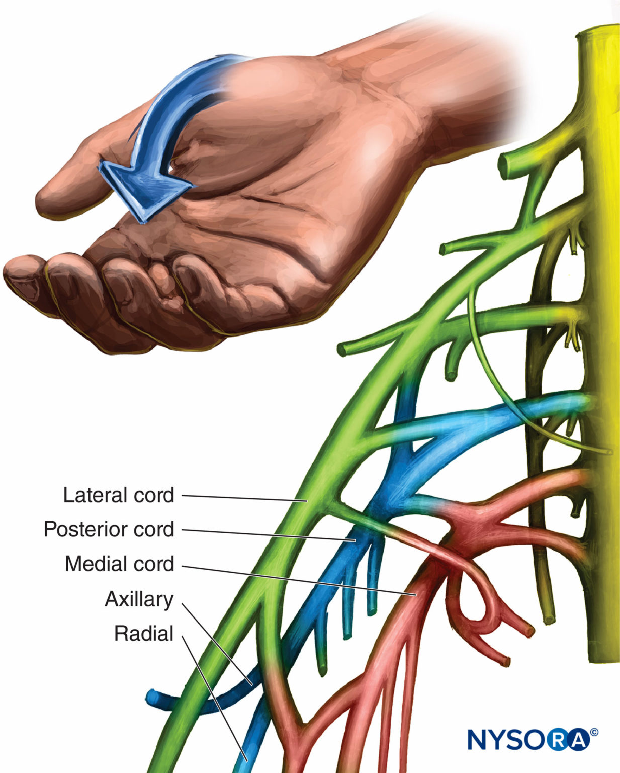 Infraclavicular Brachial Plexus Block - Landmarks and Nerve Stimulator ...