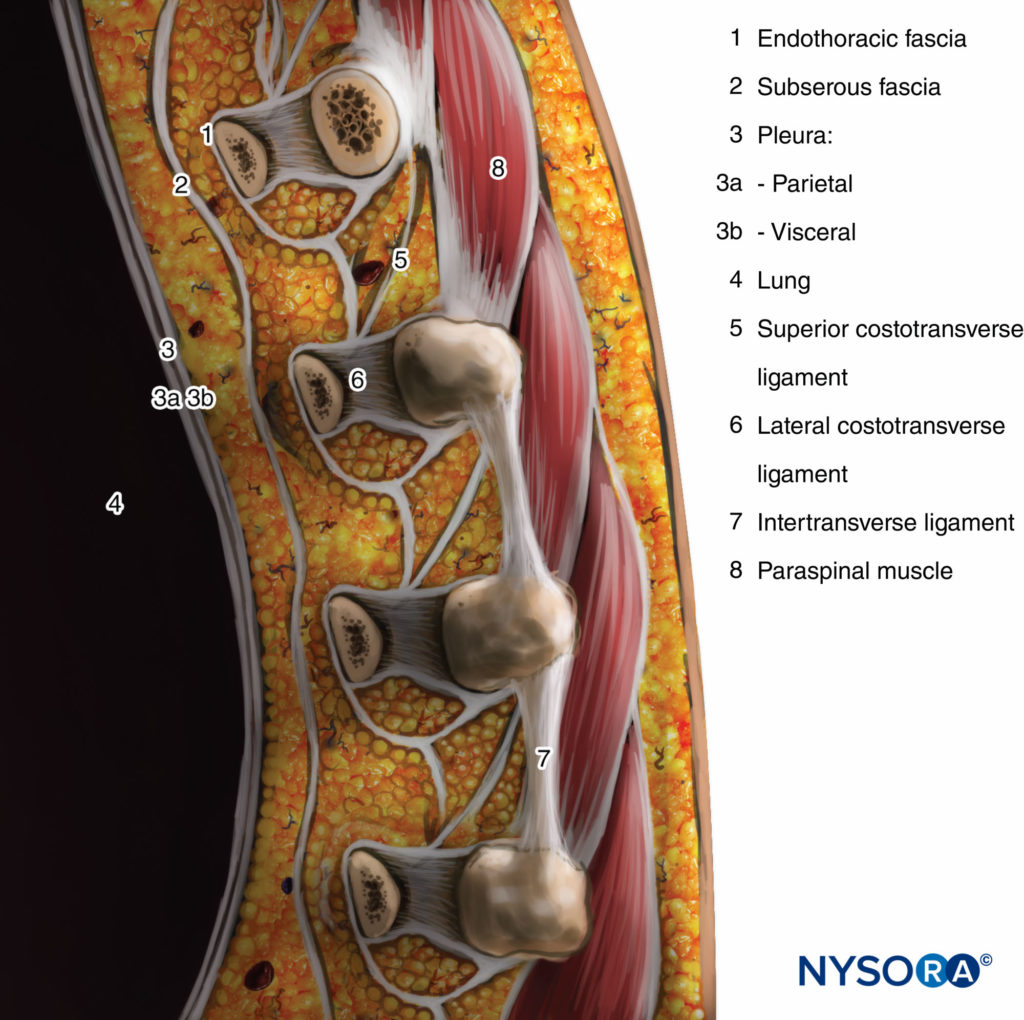 regional-anesthesia-sagittal-section.through-the-thoracic-paravertebral ... regional-anesthesia-sagittal-section.through-the-thoracic-paravertebral ...