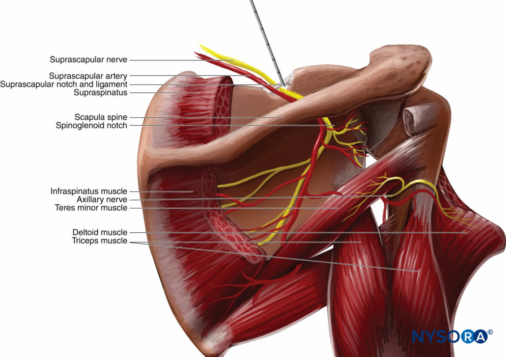 Cutaneous Blocks for the Upper Extremity - Landmarks and Nerve Stimulator Technique - NYSORA