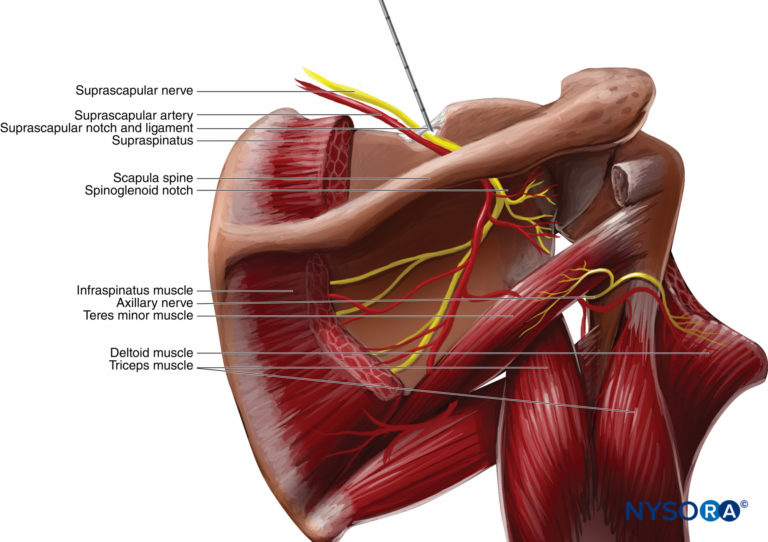 Cutaneous Blocks for the Upper Extremity - Landmarks and Nerve Stimulator Technique - NYSORA