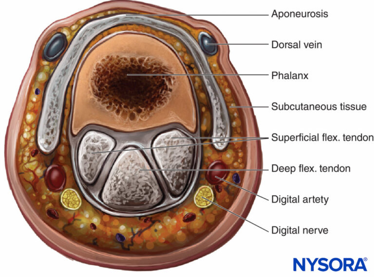 Digital Block - Landmarks and Nerve Stimulator Technique - NYSORA