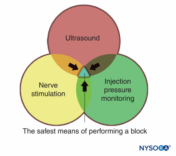 Monitoring, Documentation, and Consent for Regional Anesthesia ...