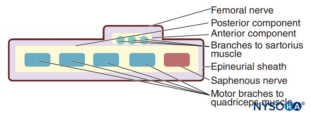 Femoral Nerve Block - Landmarks and Nerve Stimulator Technique - NYSORA