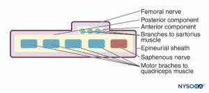 Femoral Nerve Block - Landmarks and Nerve Stimulator Technique - NYSORA