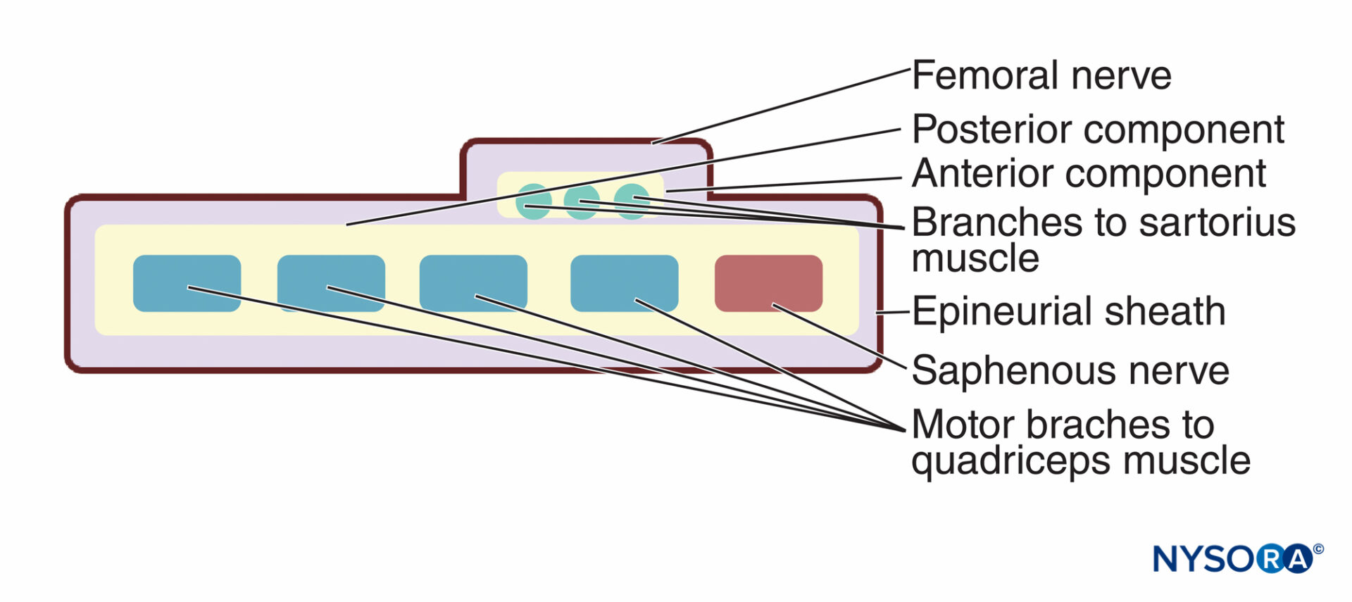 Femoral Nerve Block Landmarks And Nerve Stimulator Technique Nysora 7685