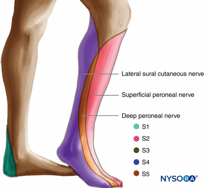 Sciatic Nerve Block - Landmarks and Nerve Stimulator Technique - NYSORA