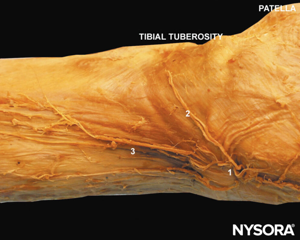 Cutaneous Nerve Blocks of the Lower Extremity - NYSORA