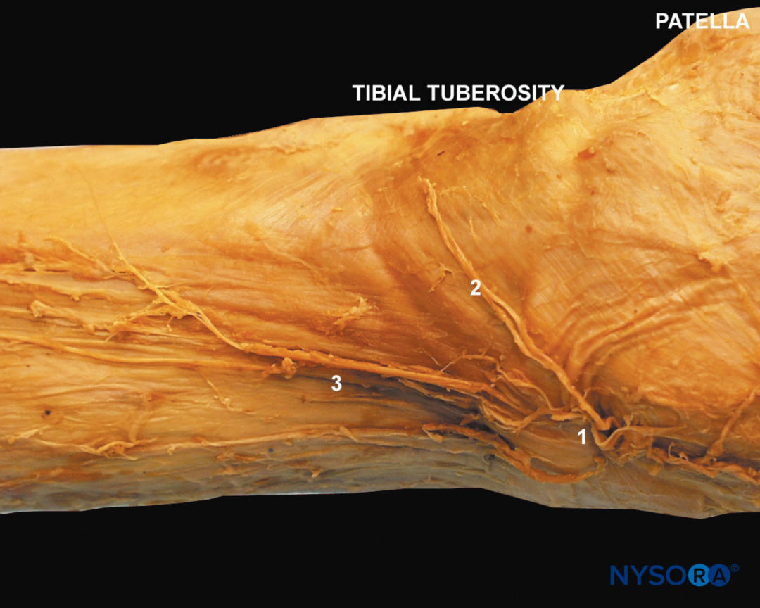 Cutaneous Nerve Blocks of the Lower Extremity - NYSORA