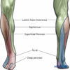 Popliteal Sciatic Nerve Block - Landmarks and Nerve Stimulator ...