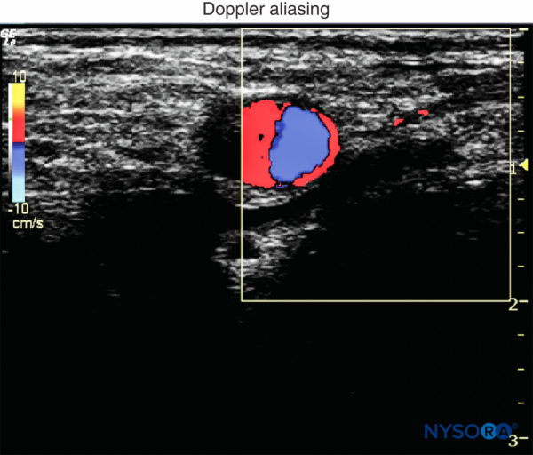 Optimizing an Ultrasound Image - NYSORA