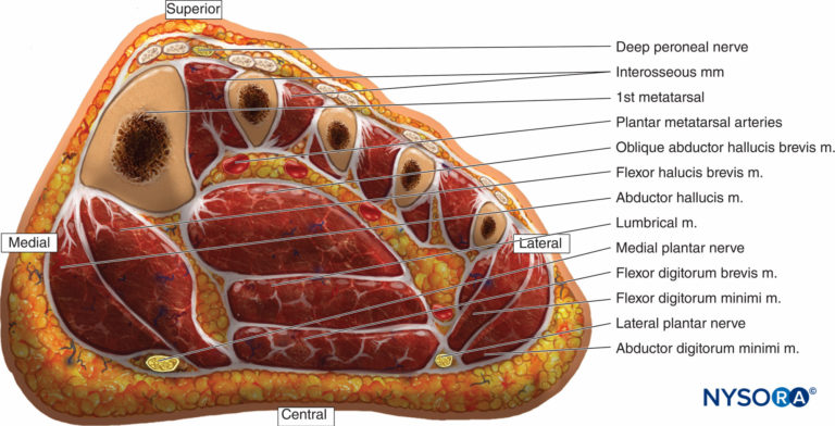 Acute Compartment Syndrome of the Limb: Implications for Regional ...