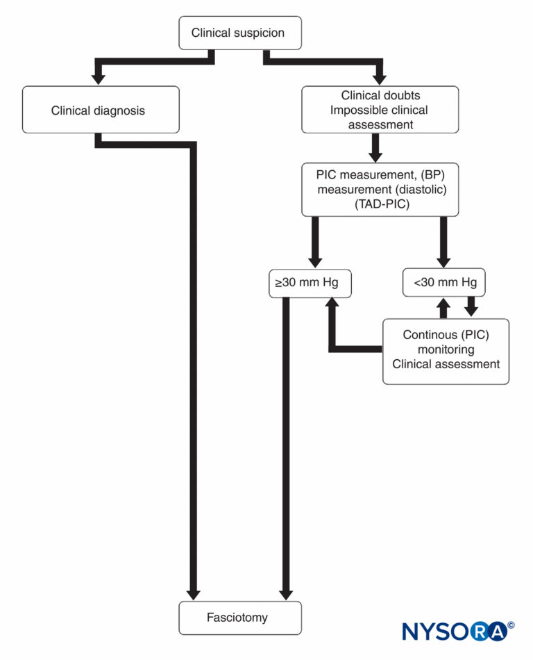 Acute Compartment Syndrome of the Limb: Implications for Regional ...