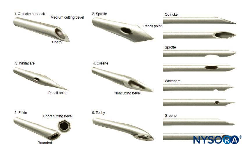 Spinal Anesthesia - NYSORA
