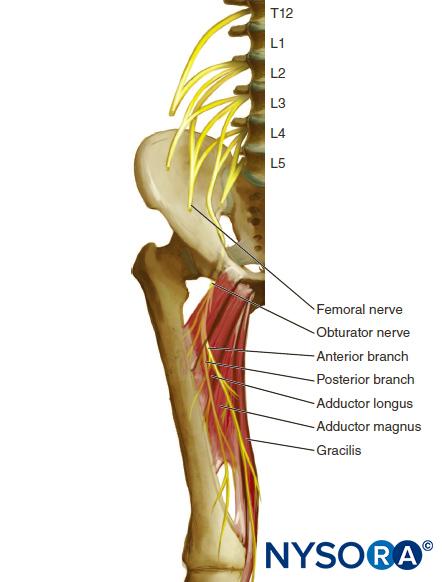 Obturator Nerve Block - Landmarks and nerve stimulator technique - NYSORA