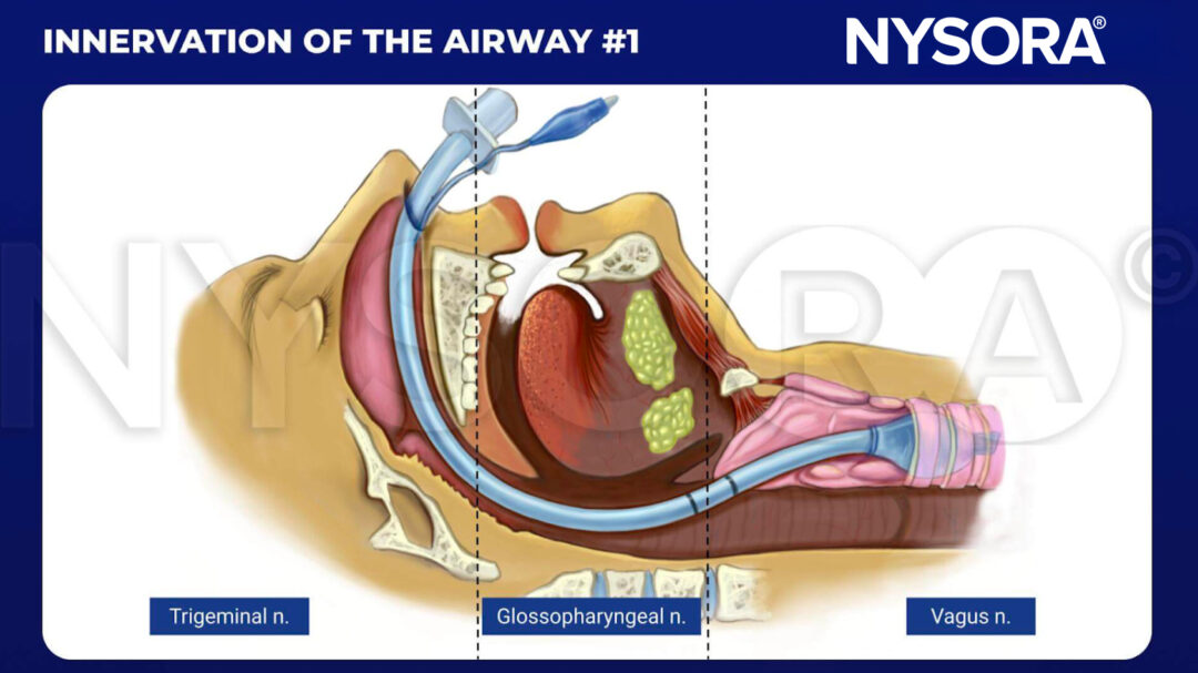 Regional and Topical Anesthesia for Awake Endotracheal Intubation - NYSORA