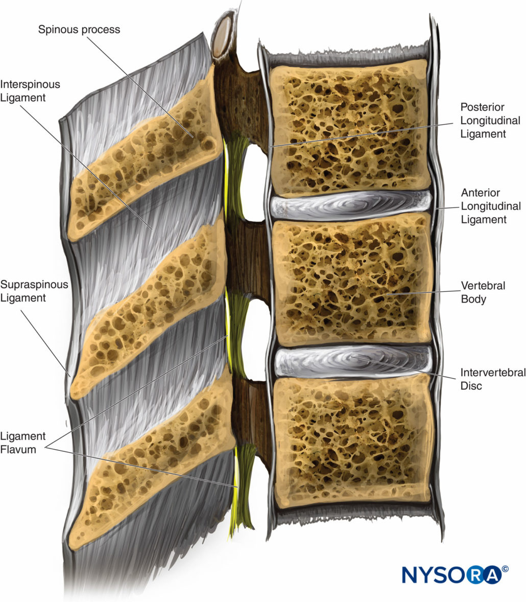 Spinal Anesthesia - NYSORA