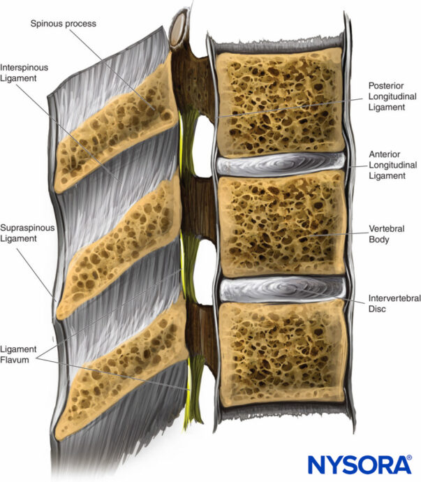 Spinal Anesthesia - NYSORA