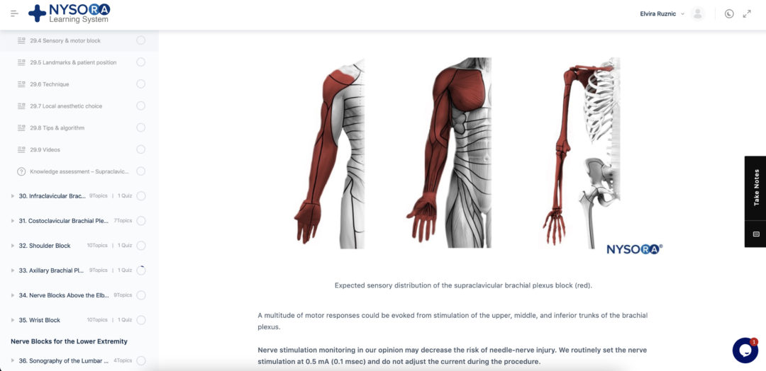 Ultrasound-Guided Supraclavicular Brachial Plexus Nerve Block - NYSORA