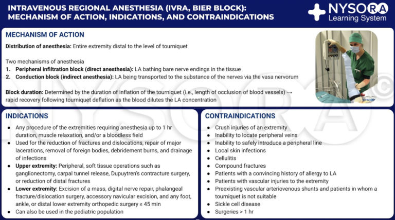 Intravenous Regional Block for Upper and Lower Extremity Surgery - NYSORA