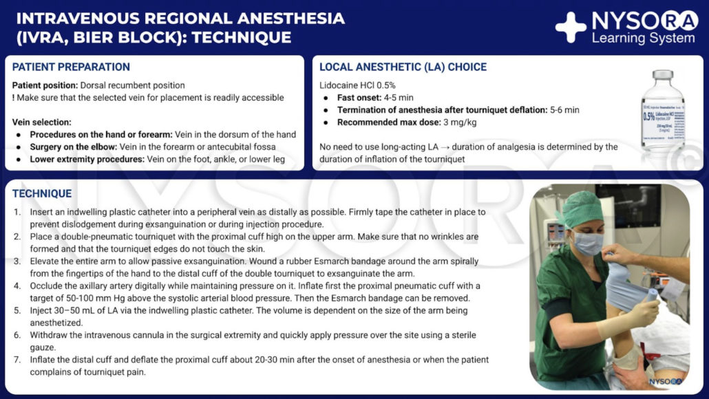 Intravenous Regional Block for Upper and Lower Extremity Surgery - NYSORA