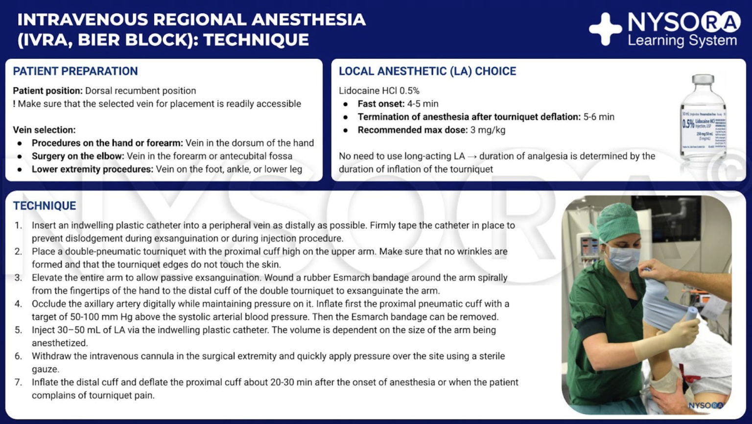 Intravenous Regional Block for Upper and Lower Extremity Surgery - NYSORA