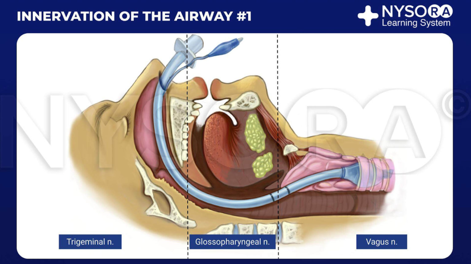 Regional and Topical Anesthesia for Awake Endotracheal Intubation - NYSORA